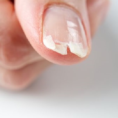 Uñas quebradizas: ¿qué hacer para que no se rompan? - Beauty Nails
